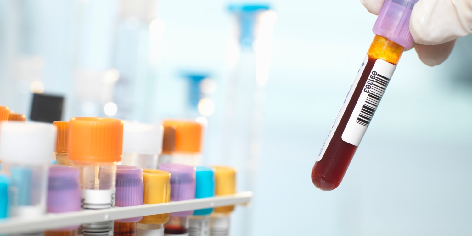Die wichtigsten Laborwerte im Überblick