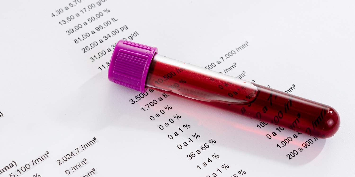 Kleines Blutbild und großes Blutbild: Diese Blutwerte werden untersucht