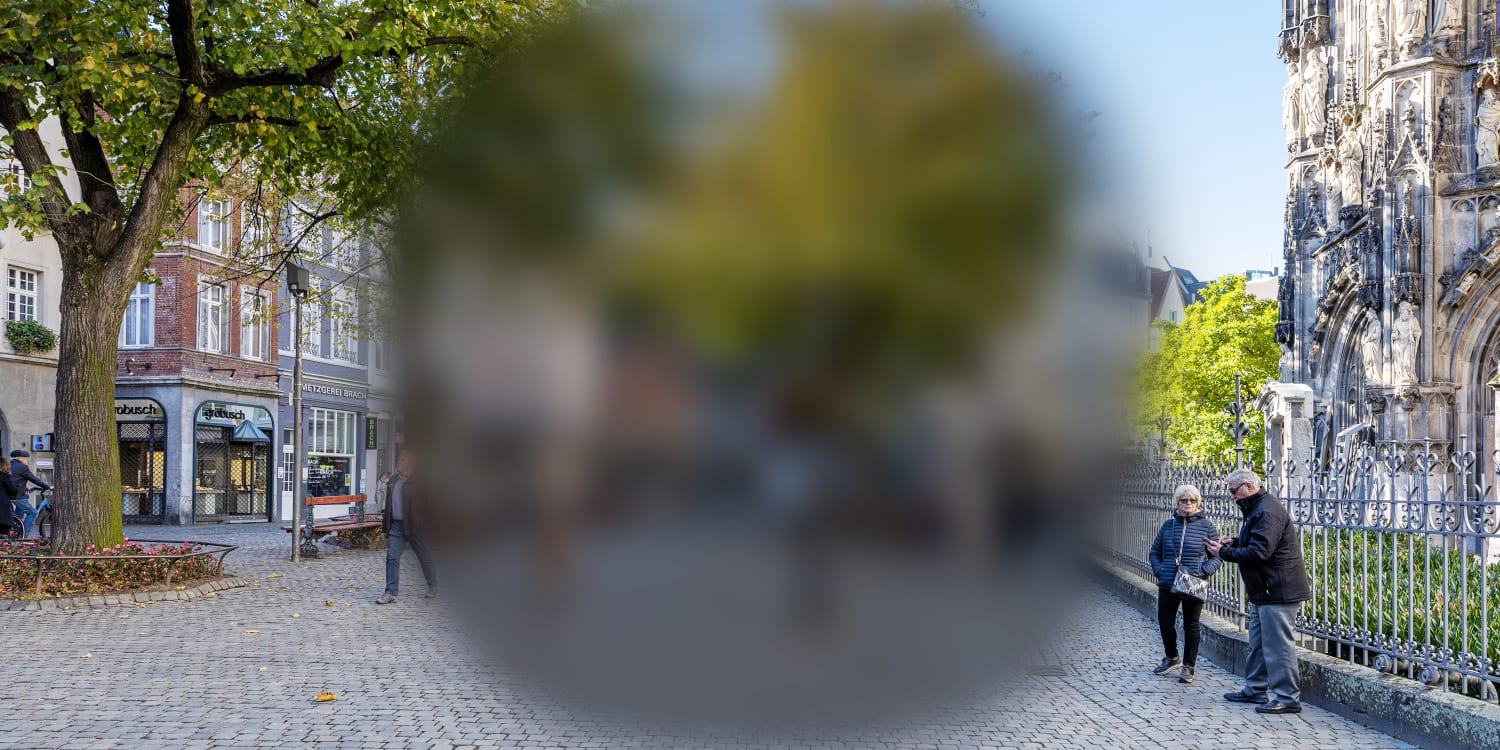 Makuladegeneration: Alles zu Symptomen, Ursachen und Behandlung