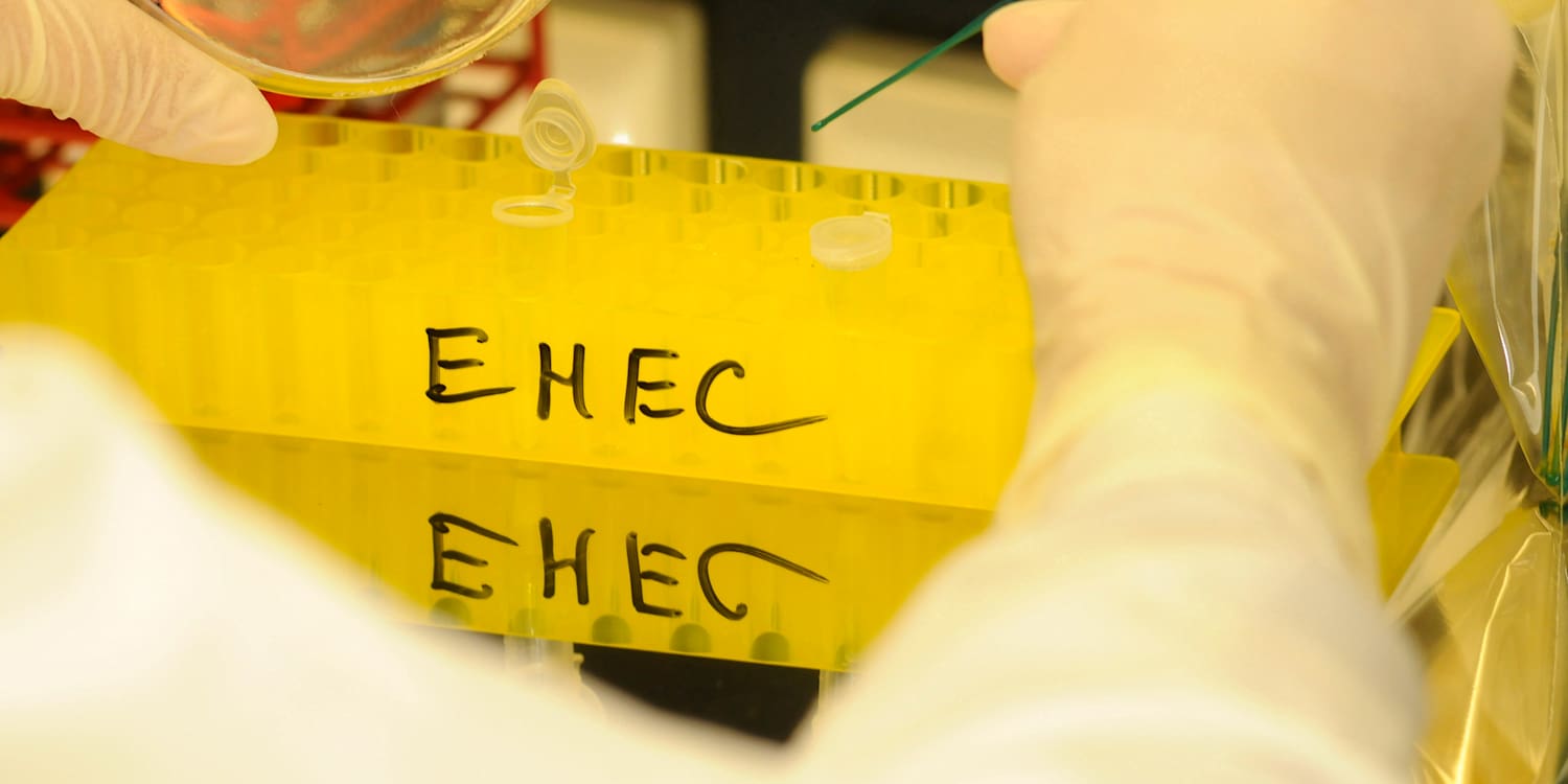 EHEC: Zwei Betroffene nach Ausbruch in Mecklenburg-Vorpommern gestorben